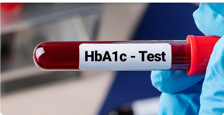 What Is Dangerous HbA1C Level ? How To Manage That?